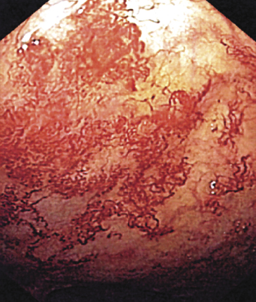 9: Radiation Effects on Tissues and Organs | Radiology Key