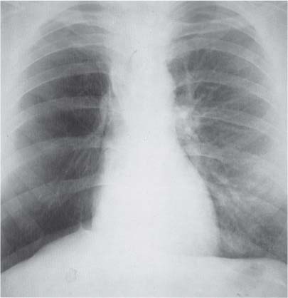 Malformations | Radiology Key