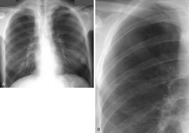Opening Round | Radiology Key