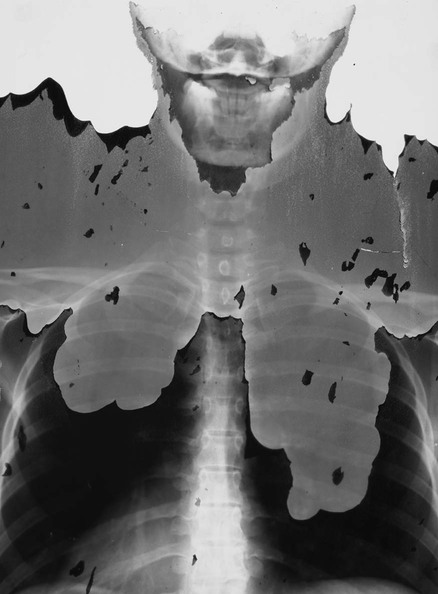 Plain Radiographic Imaging | Radiology Key