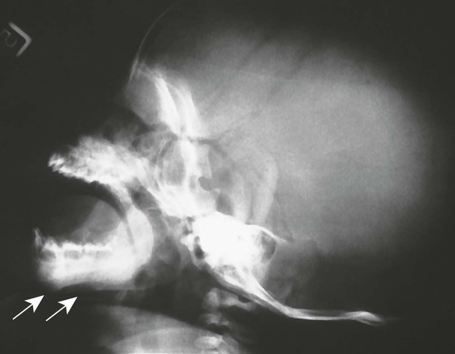 Skull Patterns | Radiology Key