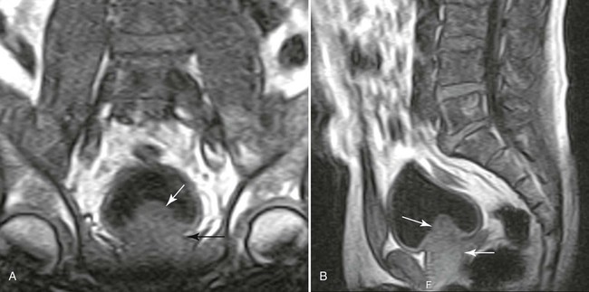 Magnetic Resonance Imaging Patterns | Radiology Key