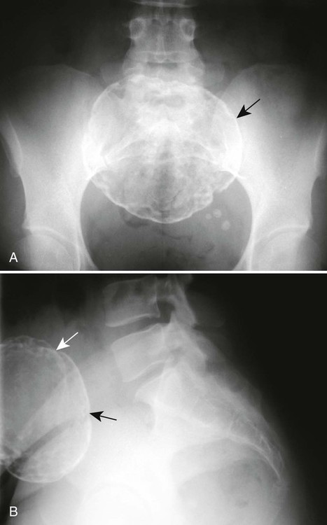 Genitourinary Diseases | Radiology Key