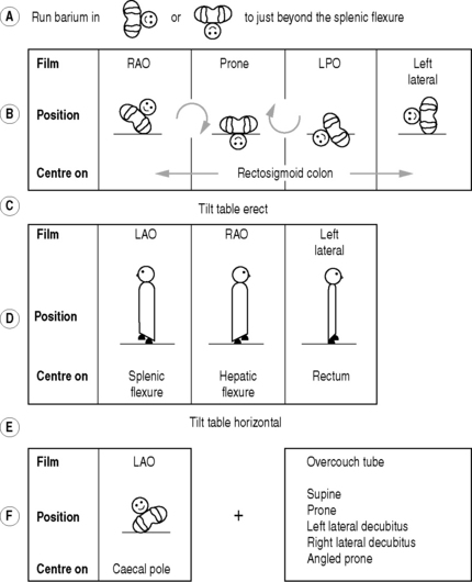 Gastrointestinal tract | Radiology Key