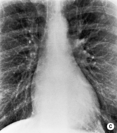 The Oesophagus | Radiology Key