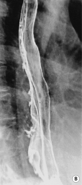 The Stomach | Radiology Key