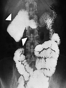 The Stomach | Radiology Key