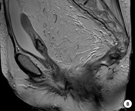 Colon | Radiology Key