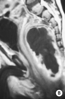 Paediatric genitourinary disorders | Radiology Key