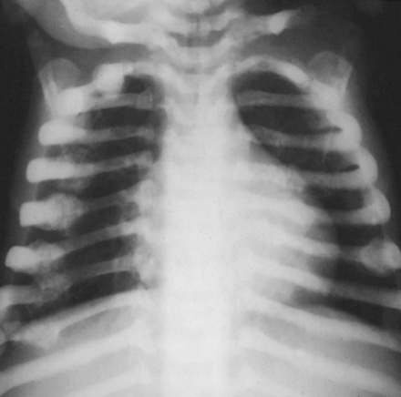 Skeletal Radiology in Children | Radiology Key