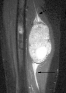 Soft tissue imaging | Radiology Key