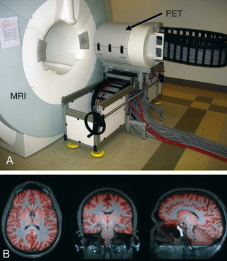 Hybrid Imaging: SPECT/CT and PET/CT | Radiology Key