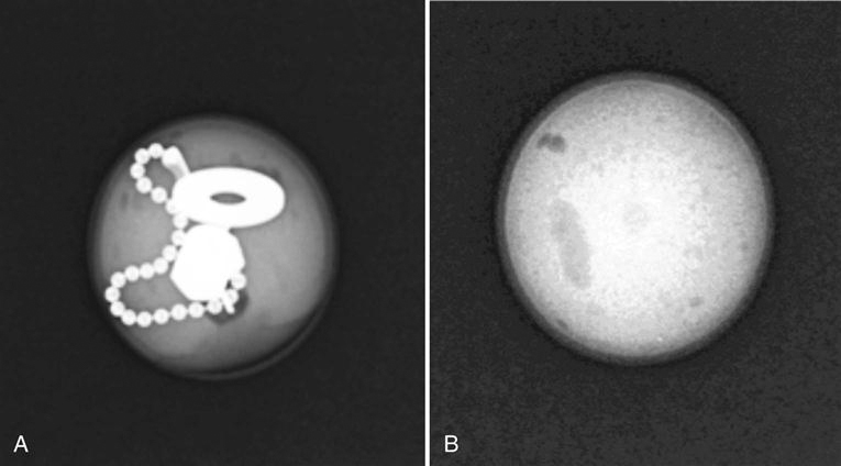 Digital Imaging Characteristics | Radiology Key