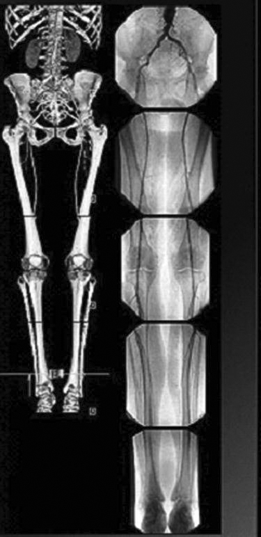 PACS Fundamentals | Radiology Key