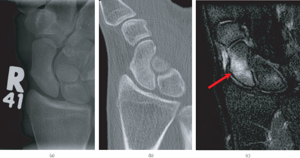 Introduction: ABCs and Rules of Two | Radiology Key
