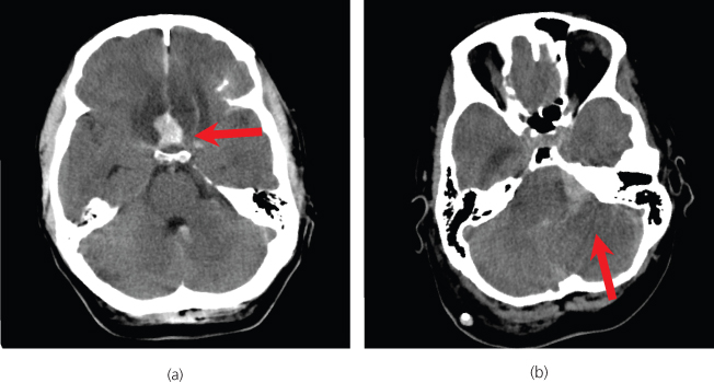 Head | Radiology Key