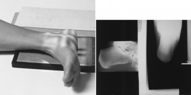 3. Radiographic Positioning | Radiology Key