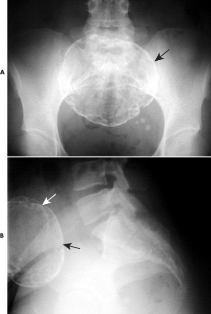 29. Genitourinary Diseases | Radiology Key