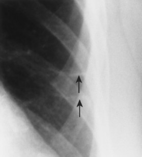23. Circulation and the Heart | Radiology Key
