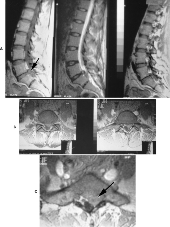 5. Film Interpretation and Report Writing | Radiology Key
