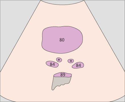 Prostate | Radiology Key