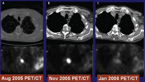 Imaging and Target Localization | Radiology Key