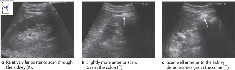Kidneys | Radiology Key