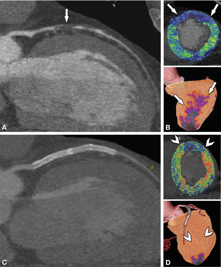 General Electric LightSpeed VCT, Optima CT660 and Discovery CT750 HD ...
