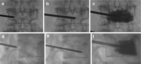 Body Augmentation | Radiology Key