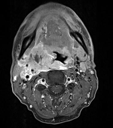 The Head and Neck | Radiology Key