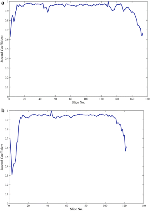 Liver Segmentation Without Prior Statistical Models | Radiology Key