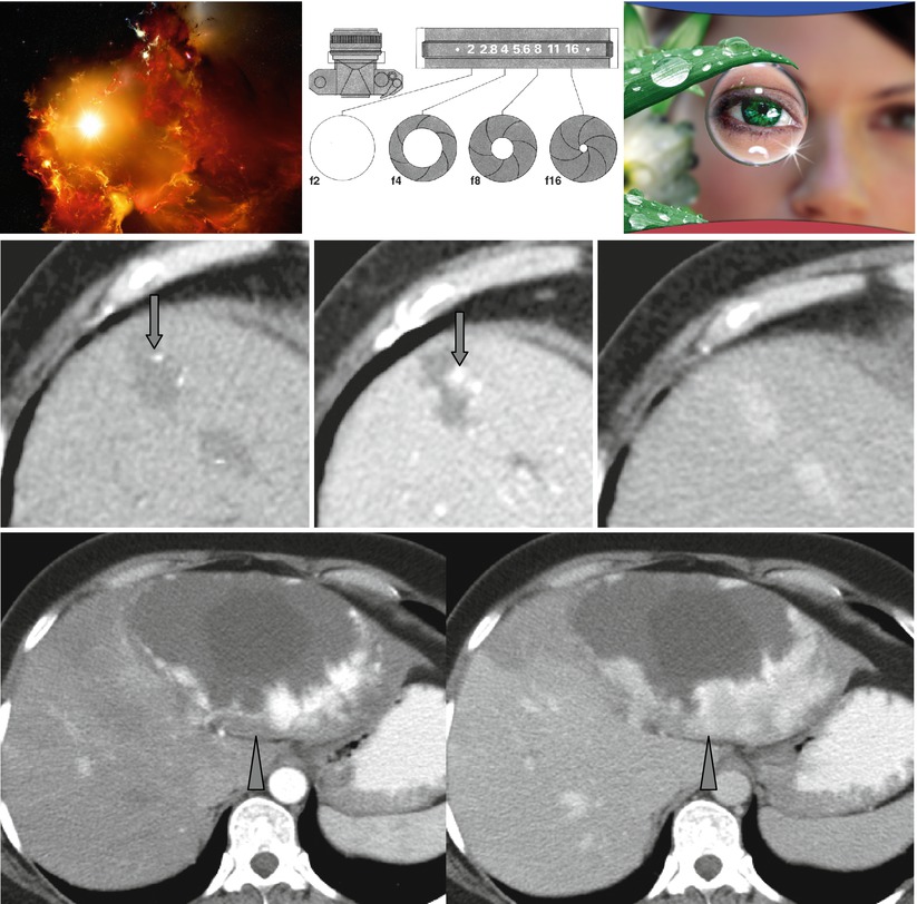 Eye Sign | Radiology Key