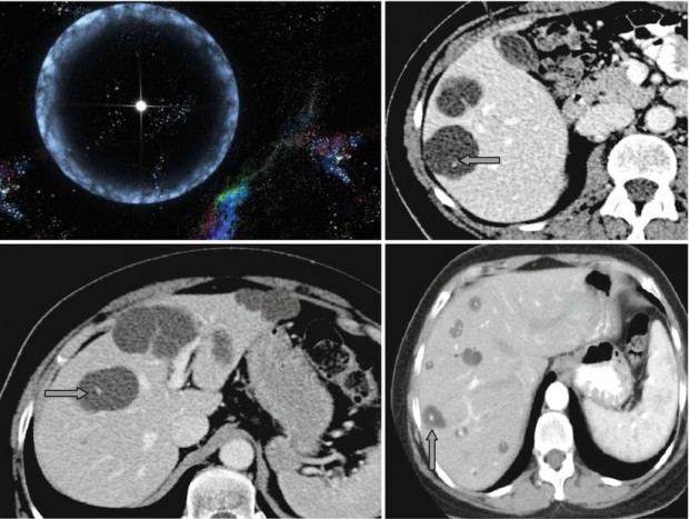 Tafelberg, or Table Mountain Sign | Radiology Key