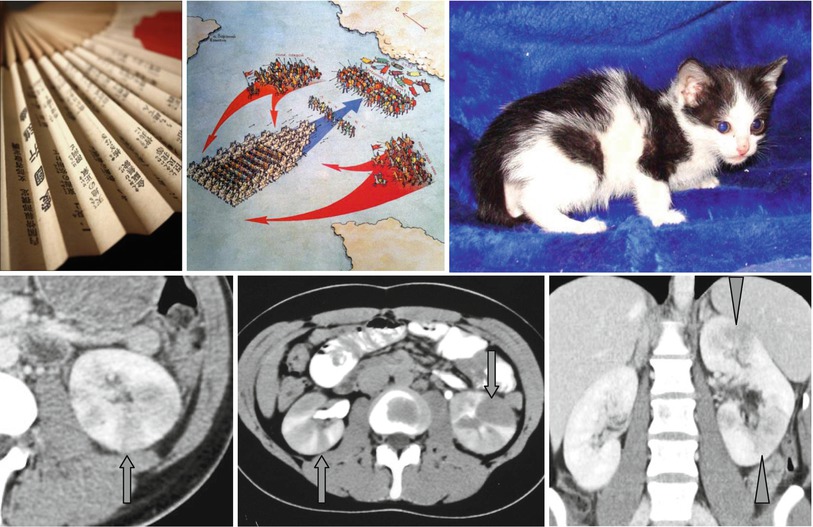 Sign, Wedge-Shaped or Striated Enhancement, and Patchy Nephrogram ...