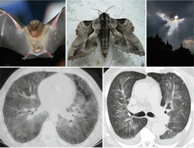 Sign | Radiology Key