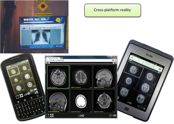 Image Quality Online | Radiology Key