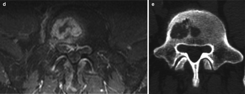 Differential Diagnosis | Radiology Key
