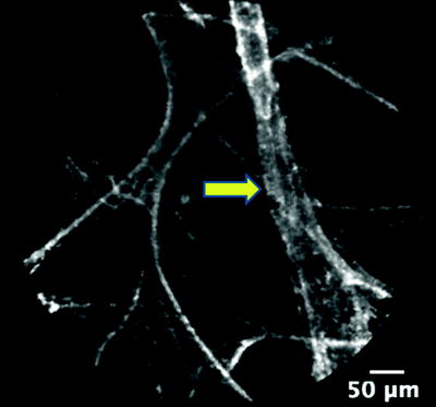 Confocal Imaging | Radiology Key