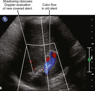 Ultrasound | Radiology Key