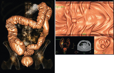 COMPUTED TOMOGRAPHY | Radiology Key