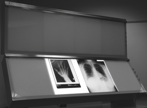 Image Processing and Display | Radiology Key