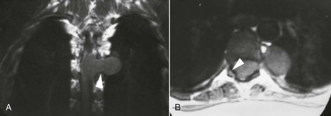 Central Nervous System | Radiology Key