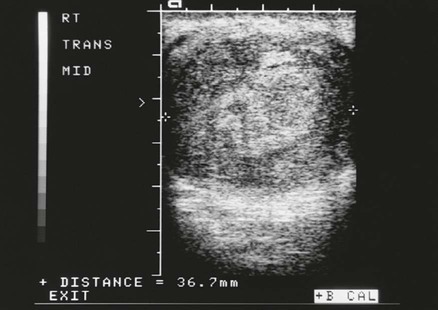 Reproductive System | Radiology Key