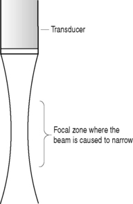 Ultrasound Beam Shape Focusing - The Best Picture Of Beam