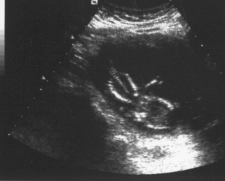 Artifacts | Radiology Key