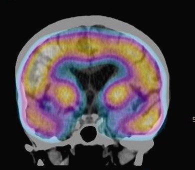Nuclear medicine imaging | Radiology Key