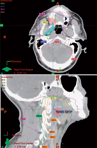 Head and Neck | Radiology Key