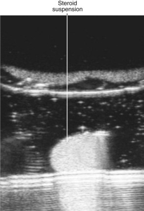 Reflection | Radiology Key
