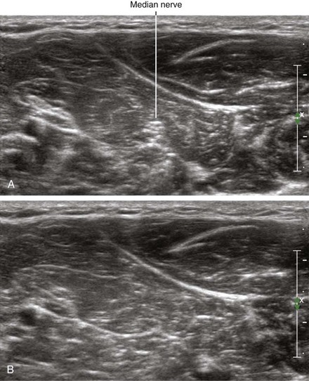 Anisotropy | Radiology Key