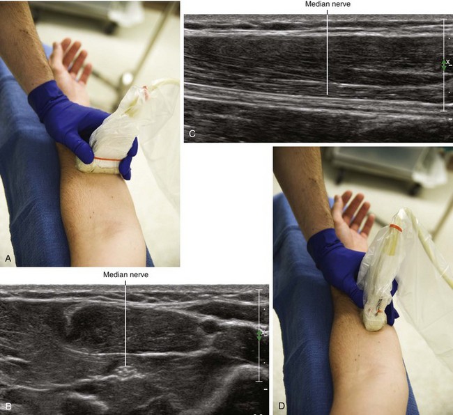 Approach and Techniques | Radiology Key